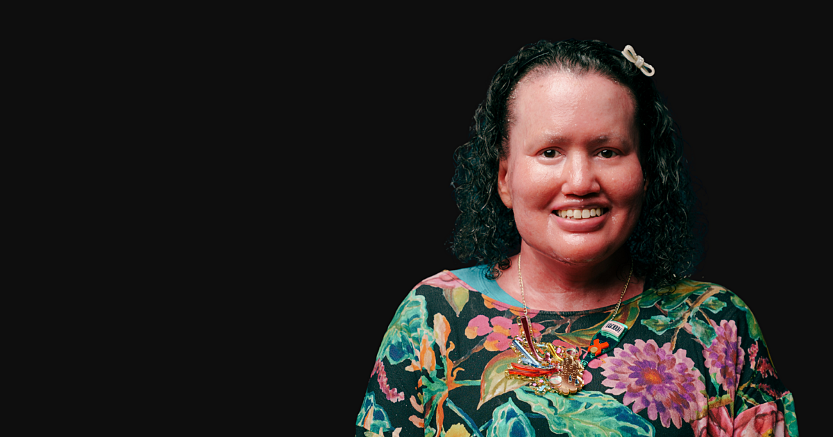 Book Carly Findlay for your next event | Saxton Speakers