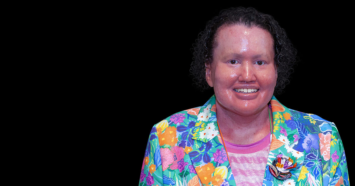 Carly Findlay | Saxton Speakers