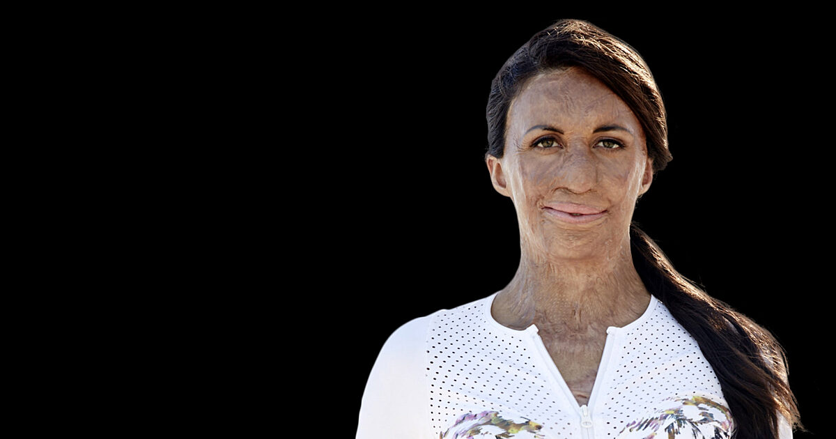 Book Turia Pitt for your Event | Saxton Speakers