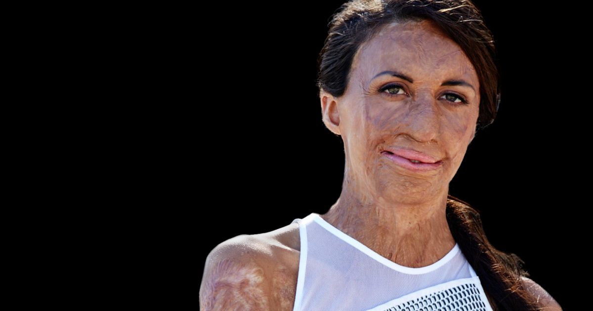 Turia Pitt | Saxton Speakers